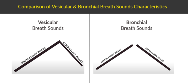 All about LUNG SOUNDS made EASY - A must-read for doctors