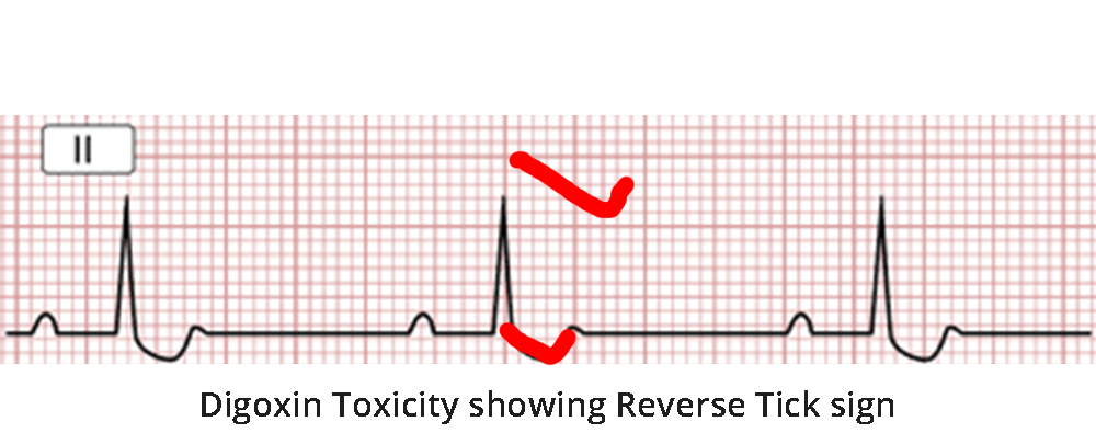 Atrial Fibrillation: 10 Most Practical Tips in AF